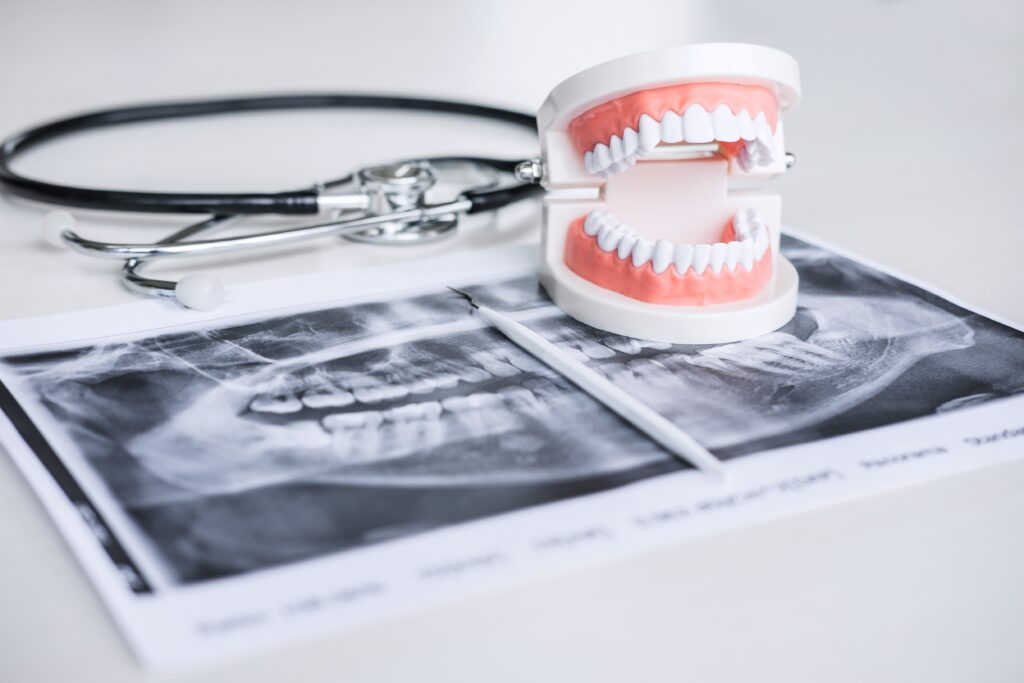 The Benefits Of Jaw Surgery For Your Oral Health