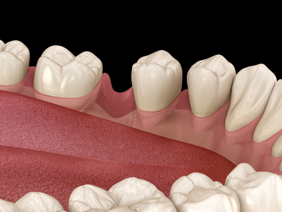 Blog | Santa Rosa & Rohnert Park Oral Surgery